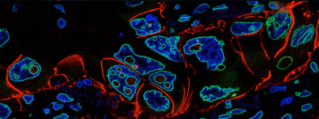 Cell Signaling & Cell/Environment Interactions – Molecular & Cellular ...